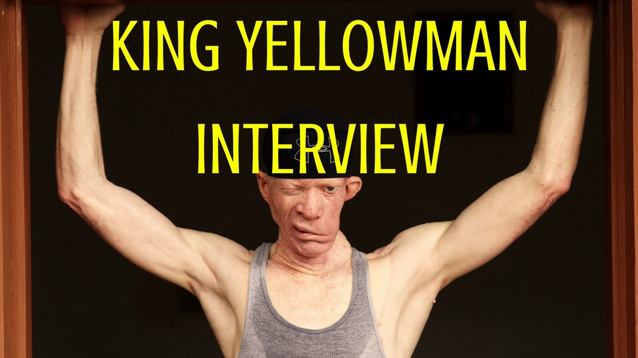 Video: Interview with Yellowman #1 @ I NEVER KNEW TV 1/6/2017